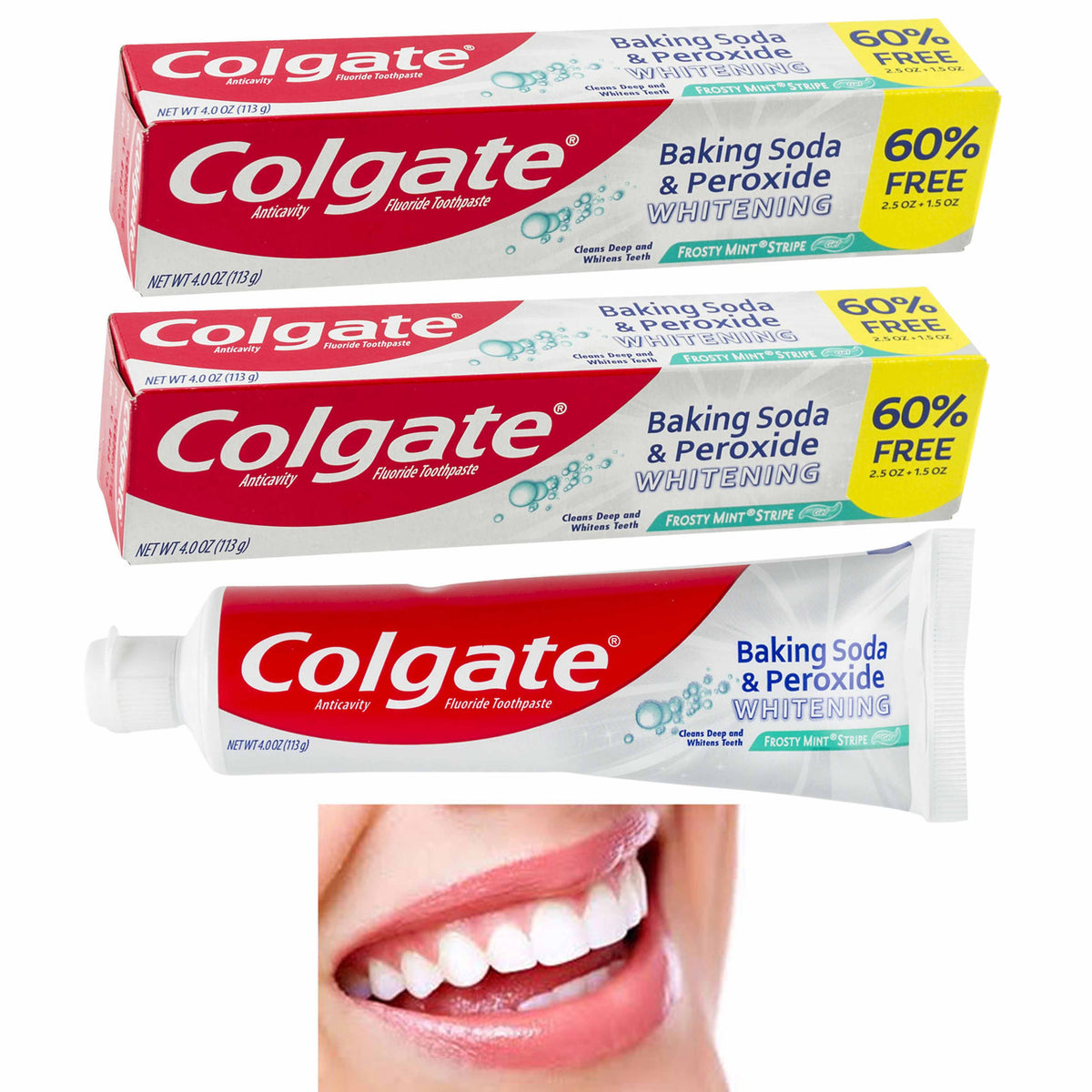 2 Colgate Teeth Whitening Toothpaste Baking Soda Peroxide Oral Anti-Ca ...